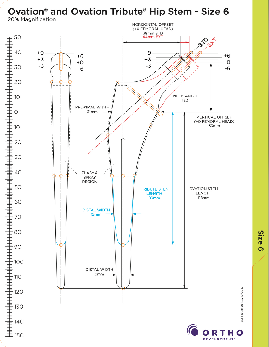 Ovation and Ovation Tribute Hip System Template – ODEV Store